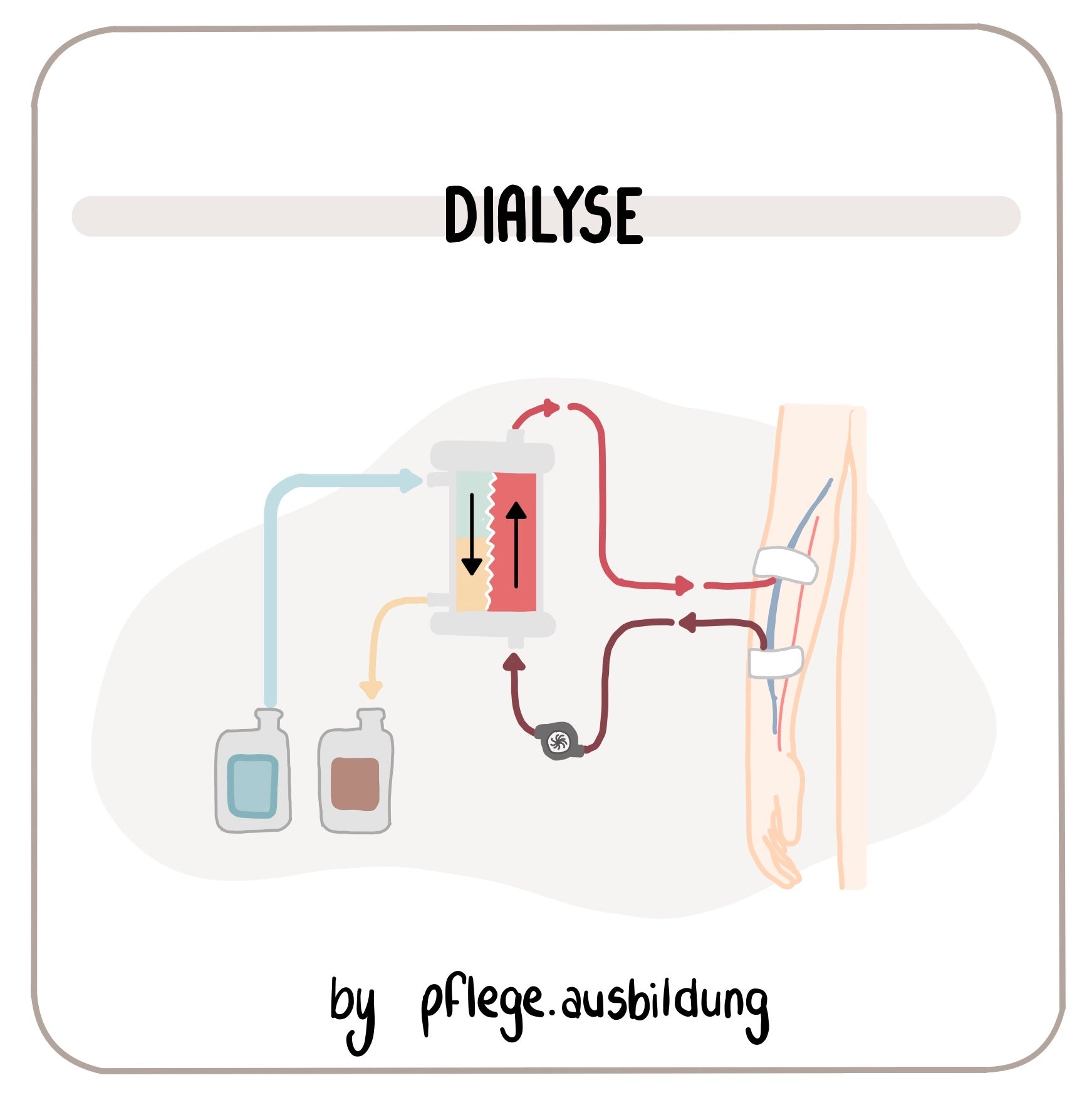 Dialyse – PFLEGELERNZETTEL